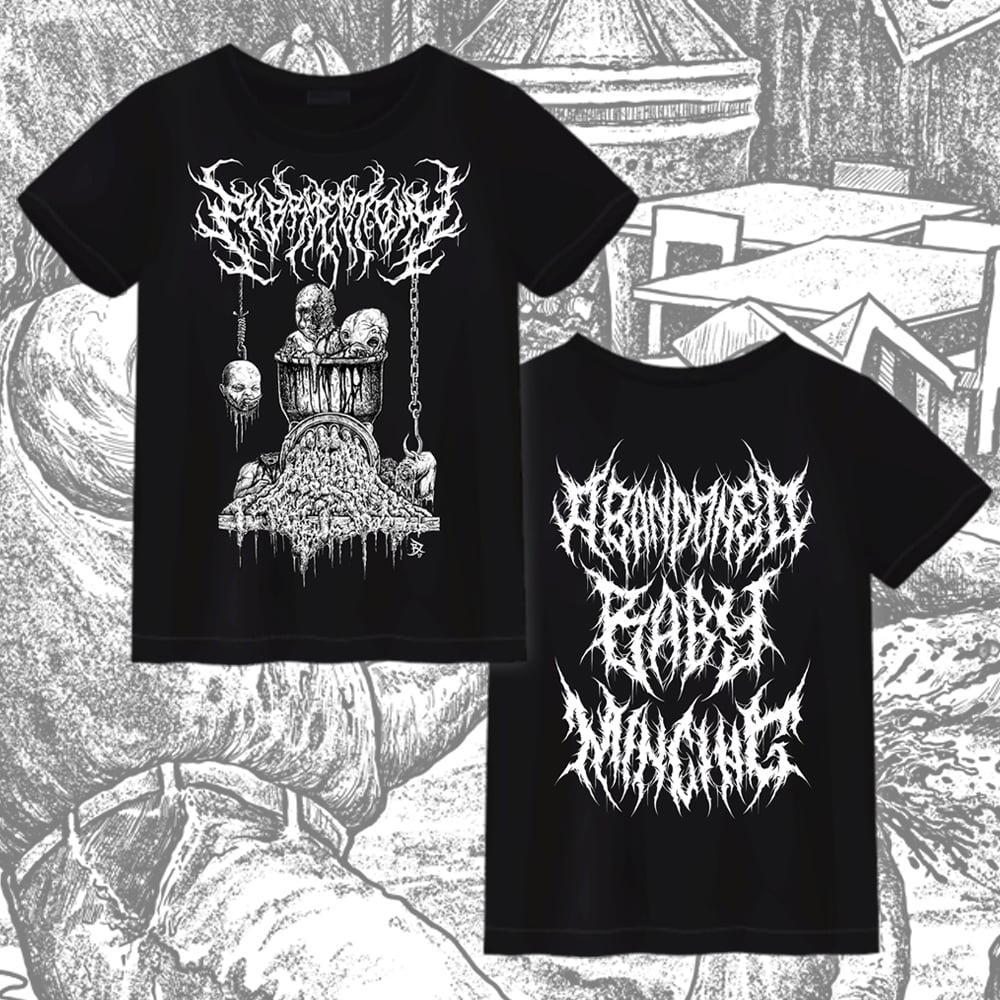 Products | Embryectomy