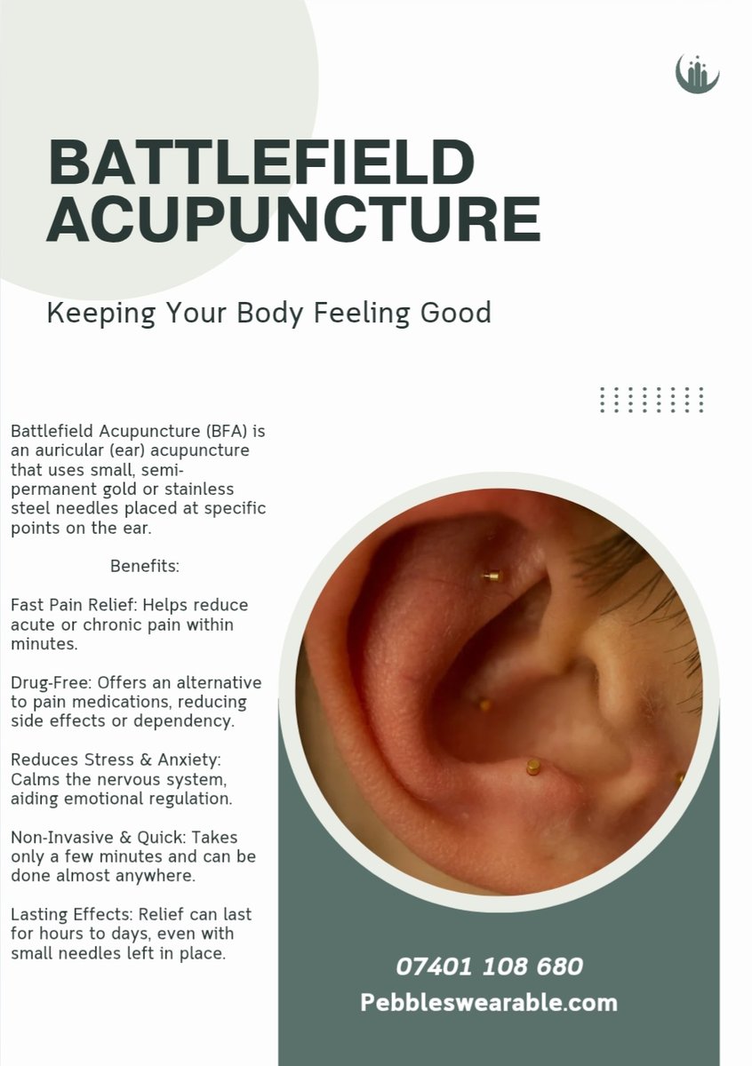 Battlefield Acupuncture Therapy | Pebbles Wearable