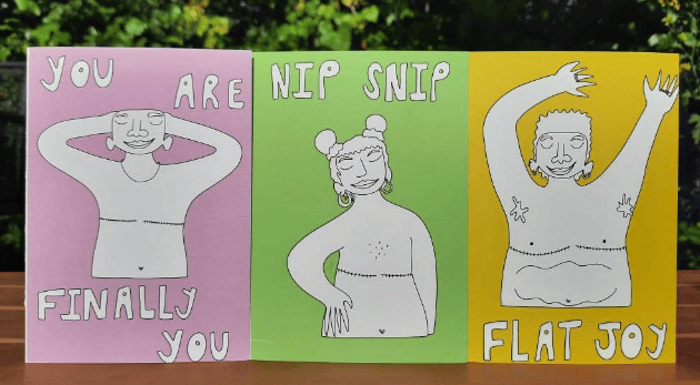 Top surgery cards | FLATBOY